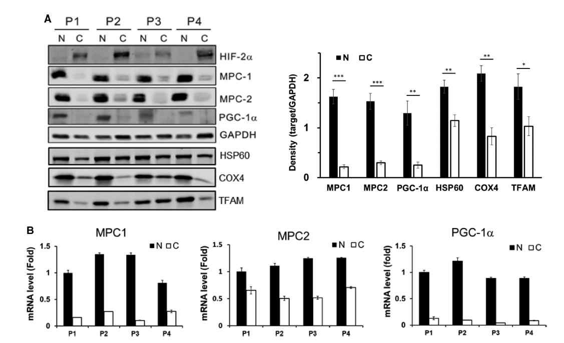 [보고서]MPC (mitochondrial pyruvate carrier)의 발현과 활성 조절을 통한 세포 기능 제어 연구