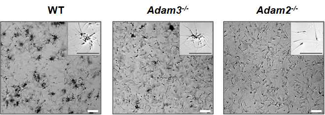 [보고서]ADAM 단백질 네트워크 분석 연구