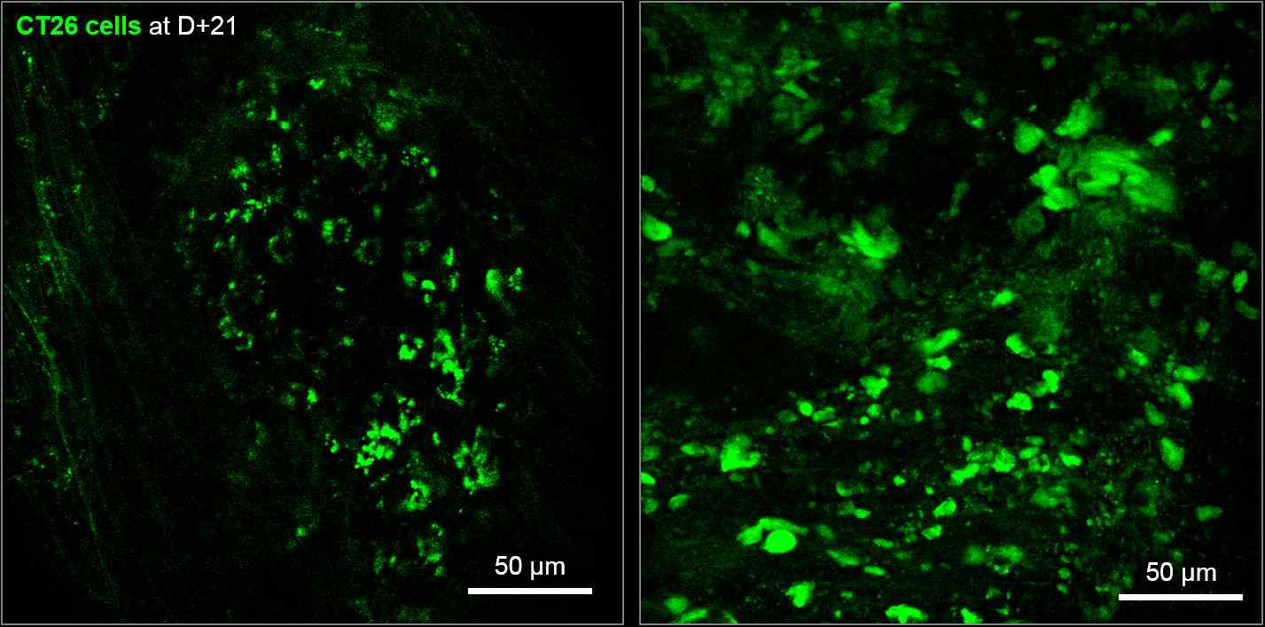 [보고서]다중모드 분자영상기반 광학생검용 디지털 소화기내시경시스템 및 마이크로광학기술