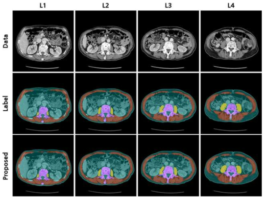 [보고서]인공지능을 이용한 암환자의 예후 및 합병증 예측 모델 개발