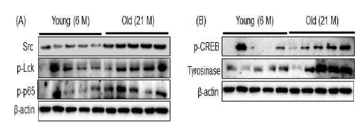[보고서]피부 노화과정에서 PTK/PTP 불균형으로 인한 색소침착 기전 및 제어 연구