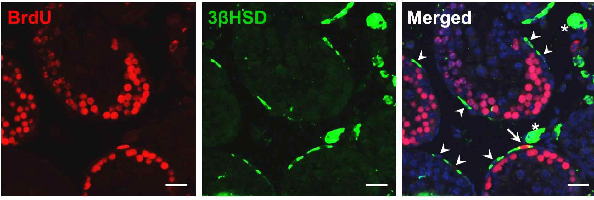 [보고서]세포 특이적 p57kip2 적중 생쥐모델을 이용한 성체 레이디세포 계보의 분화기전 규명