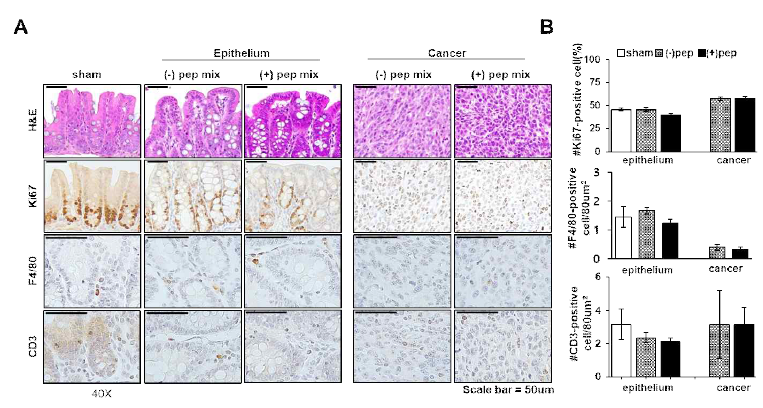 [보고서]혈중 syndecan-2 조각에 의한 대장암 활성화 기전연구