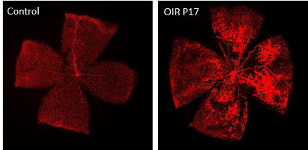 [보고서]미숙아망막병증 동물 모델에서 Toll-like Receptor 2의 역할