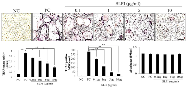 [보고서]흰쥐 치주염 및 뼈모세포와 뼈파괴세포 상호작용에 대한 SLPI의 기능