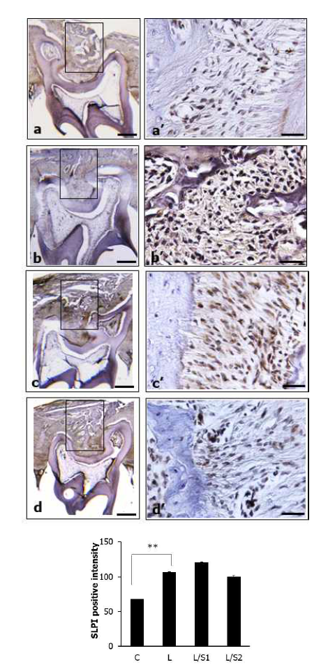 [보고서]흰쥐 치주염 및 뼈모세포와 뼈파괴세포 상호작용에 대한 SLPI의 기능