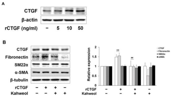 [보고서]CTGF 신호전달체계가 혈관평활근세포 증식에 미치는 영향