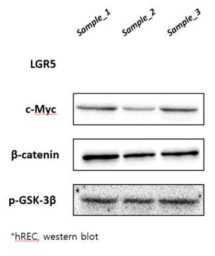 [보고서]안구 내 병적 신생혈관에 대한 생체표지자로서의 Leucine-rich G Protein-coupled Receptor ...
