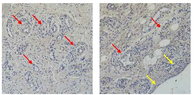 [보고서]연골의 세포사에 글루타메이트 및 에스트로젠 수용체의 역할
