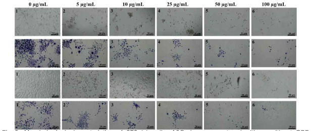 [보고서]GRAS에 등재된 식물 3종 혼합 추출 조성물의 항비만 효능 및 분자 생물학적 기작 규명 연구