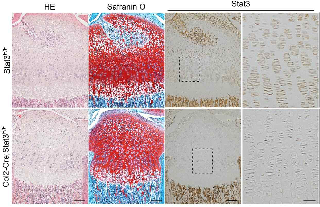 [보고서]관절연골 특이 Stat3 결손 생쥐에서 골관절염 억제 기전 규명
