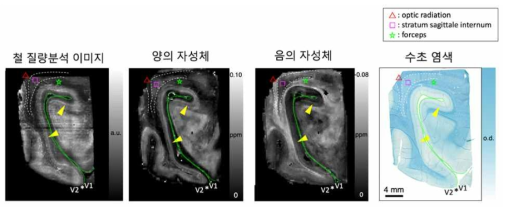 [보고서]정량적 뇌 미세구조체 정보 영상화 기법 연구