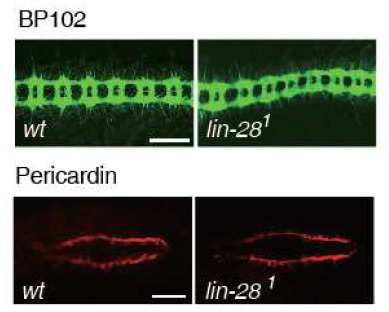 [보고서]초기 발생 과정에서 전사후 조절에 관여하는 RNA-단백질 복합체 연구