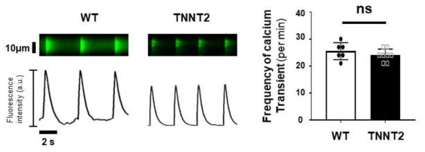 [보고서]인간 전분화능 줄기세포 유래 심근세포에서 심근병증 유전자 TNNT2 변이 기능 연구