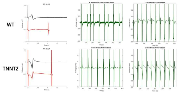 [보고서]인간 전분화능 줄기세포 유래 심근세포에서 심근병증 유전자 TNNT2 변이 기능 연구