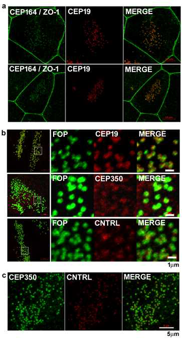 [보고서]다중 섬모세포의 기저체 극성화 분자 기전 규명