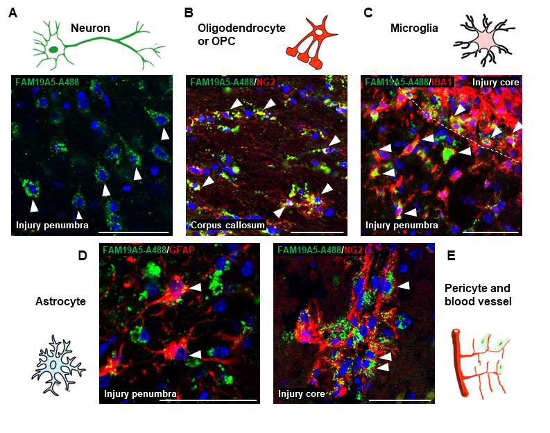 [보고서]알츠하이머병에서 FAM19A5의 기능규명