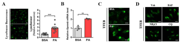 [보고서]비알콜성 지방간염 발병과 치료에 있어 Lysosome-TFEB axis의 기능적 역할 규명
