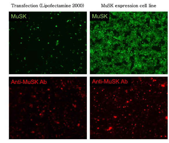 [보고서]세포기반분석법을 이용한 중증근육무력증 관련 항-MuSK 항체 검사법 확립, 개선 및 적용
