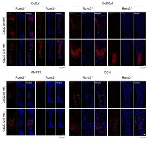 [보고서]골관절염하 연골세포 항상성에서 인산염 및 칼슘-인 결정체의 작용