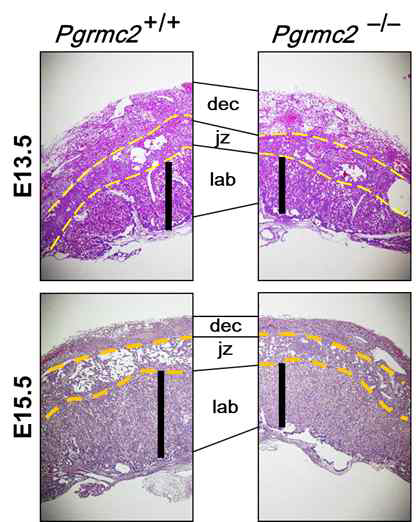 [보고서]태반 유래의 임신유지 단백질 발굴 및 작용기전 연구