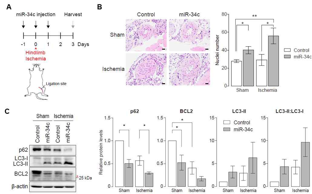 [보고서]심장동종이식혈관병증 (cardiac allograft vasculopathy; CAV)에서 과발현되는 miRNA와 ...