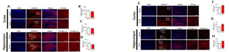 [보고서]베타 아밀로이드에 결합하는 도파민 유사체인 ca140의 알츠하이머병 및 파킨슨병 병리 저해기전 연구