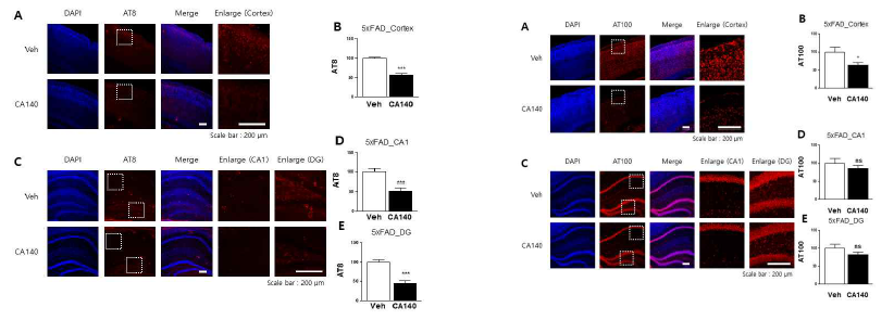 [보고서]베타 아밀로이드에 결합하는 도파민 유사체인 ca140의 알츠하이머병 및 파킨슨병 병리 저해기전 연구