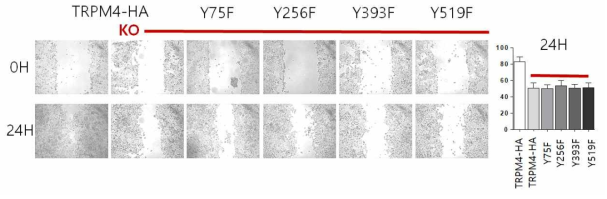 [보고서]타이로신 인산화에 의한 TRPM4 통로이동 및 활성조절기전