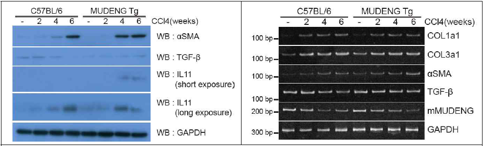 [보고서]간 섬유화 및 간경변증 과정에서 MUDENG 단백질의 역할 규명