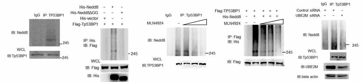 [보고서]TP53BP1 단백질 번역 후 변형을 통한 게놈 안정성 조절 기전 연구