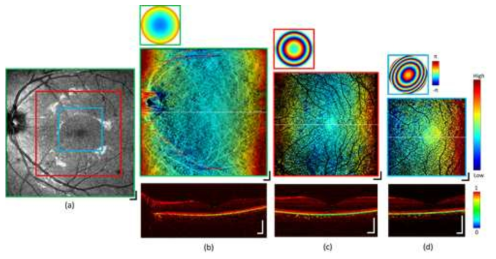 [보고서]한국베크만광의료기기연구센터(BLI-Korea)